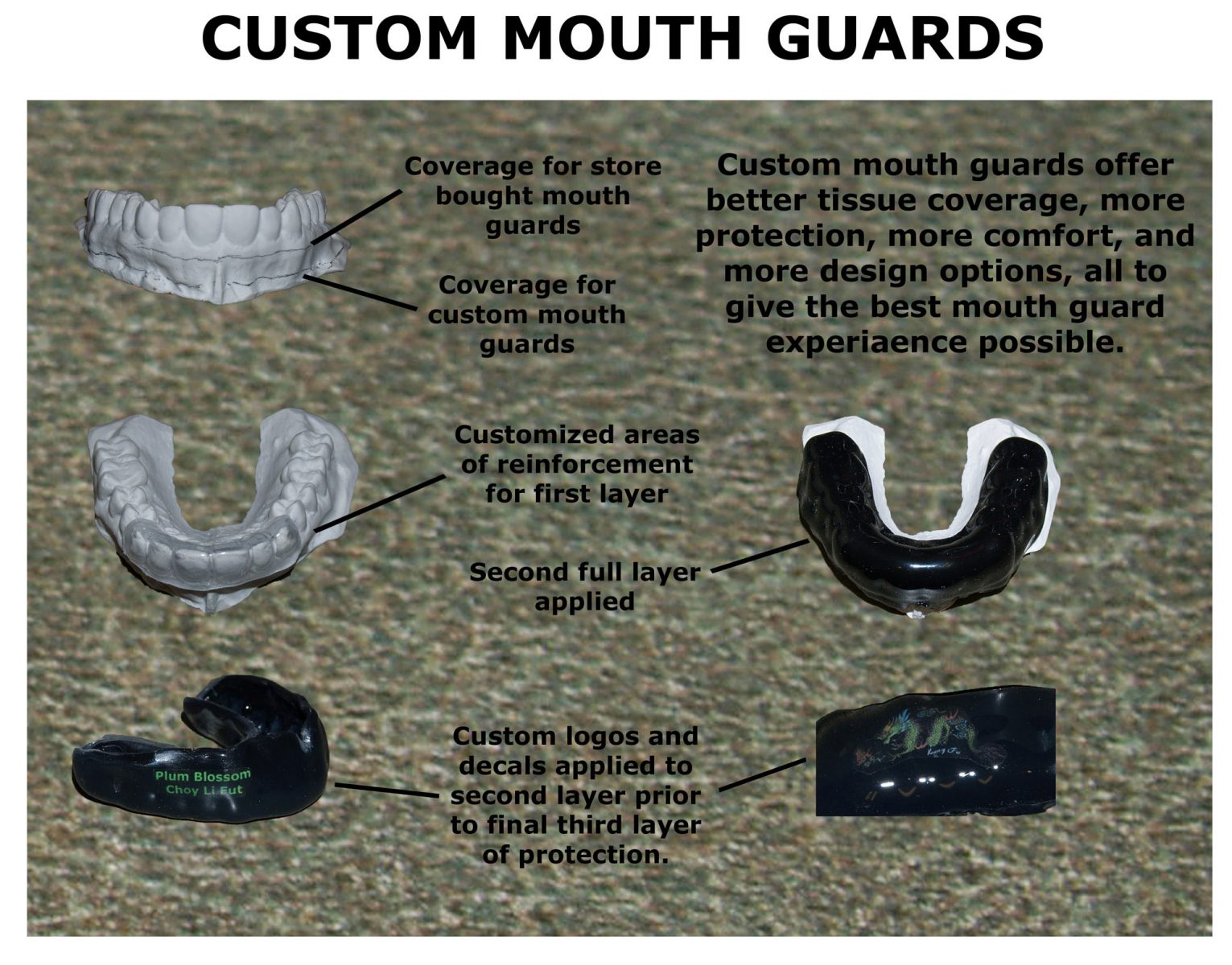 Custom Mouthguards My Family Dentist Custom Mouthguards My Family Dentist